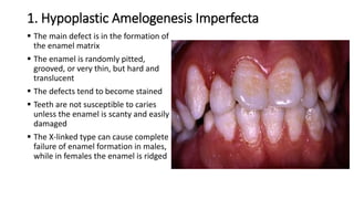 Defects of tooth structure | PPTX