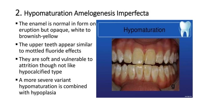 Defects of tooth structure | PPTX | Dental Health | Diseases and Conditions