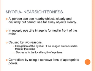 Defects of vision | PPTX