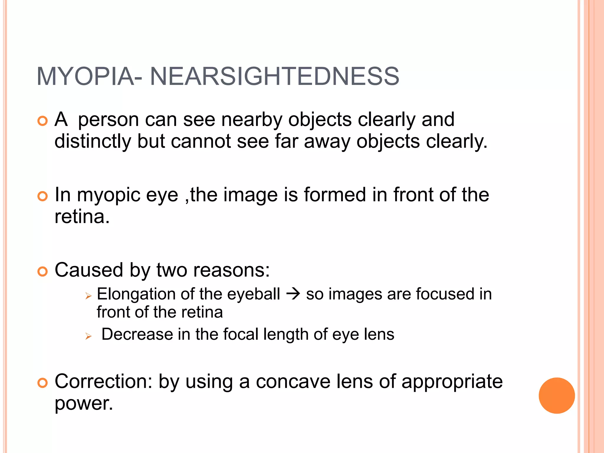 Defects of vision | PPTX