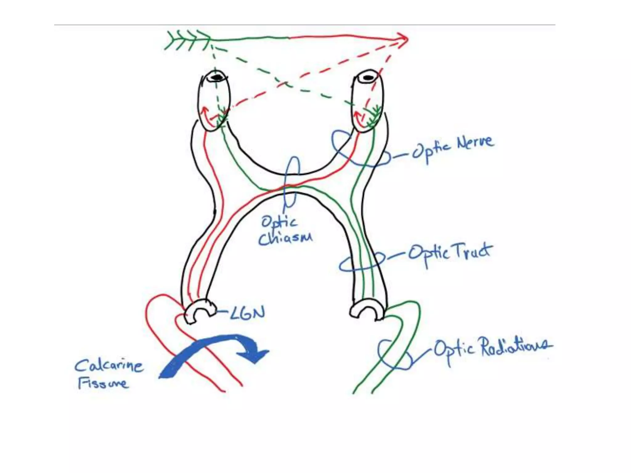 Defects of visual pathway | PPTX