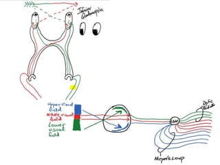 Defects of visual pathway | PPTX