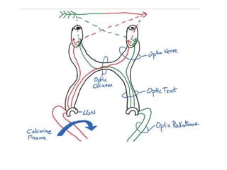 Defects of visual pathway | PPTX