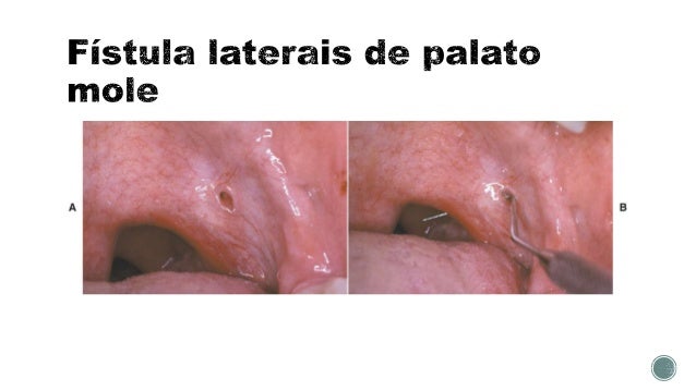 Defeitos do desenvolvimento da região bucal e anomalias