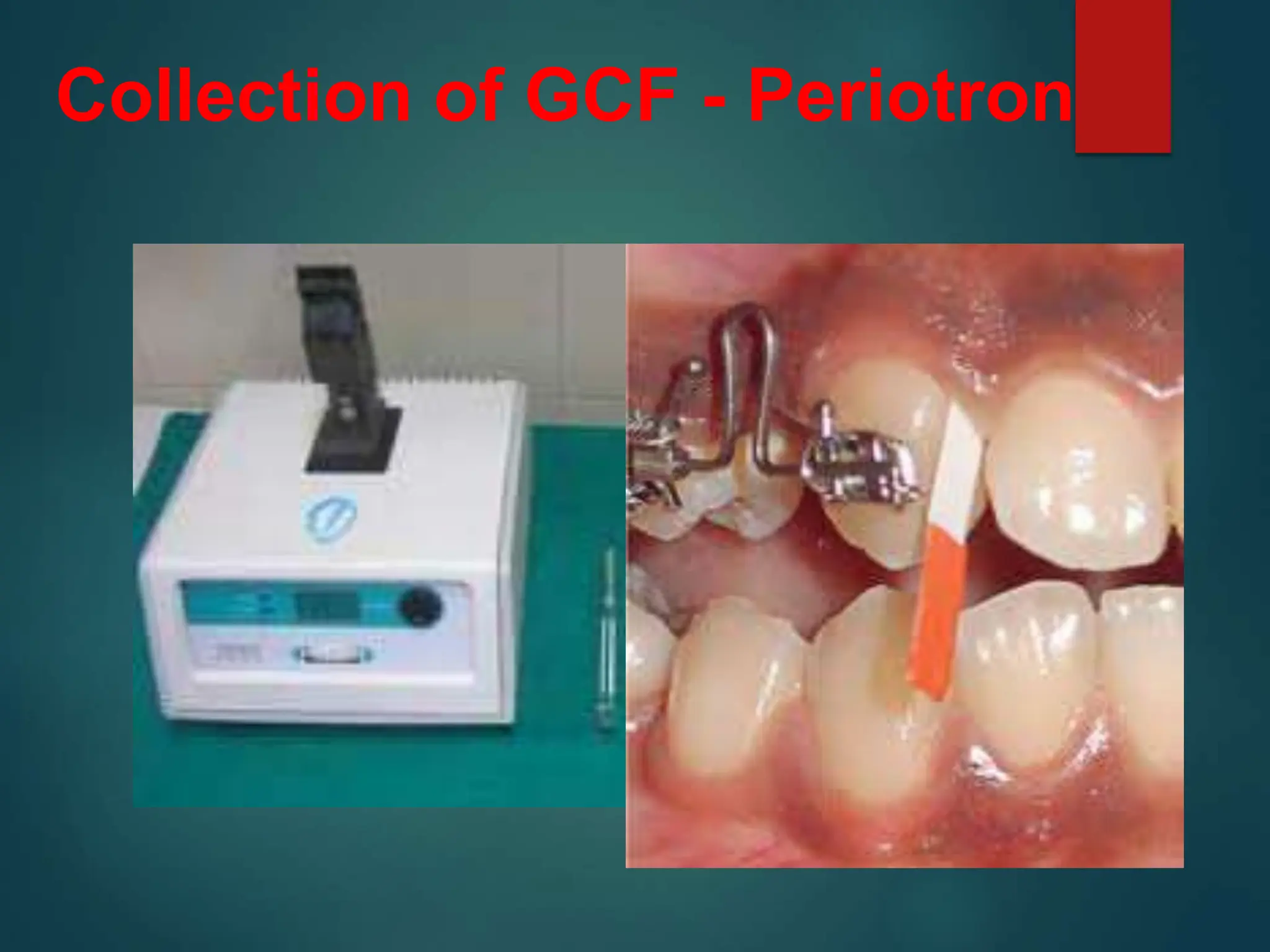 Defence Mechanism of Gingiva and periodedontiom.ppt