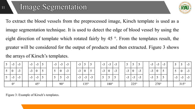Classification of Diabetic Retinopathy.pptx | Diabetes | Diseases and ...