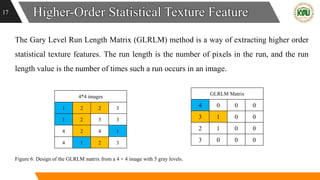 Classification of Diabetic Retinopathy.pptx
