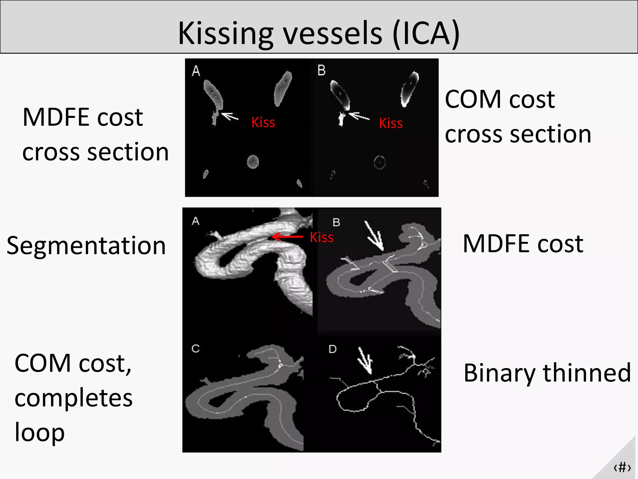 Arterial tortuosity measurement system | PPTX