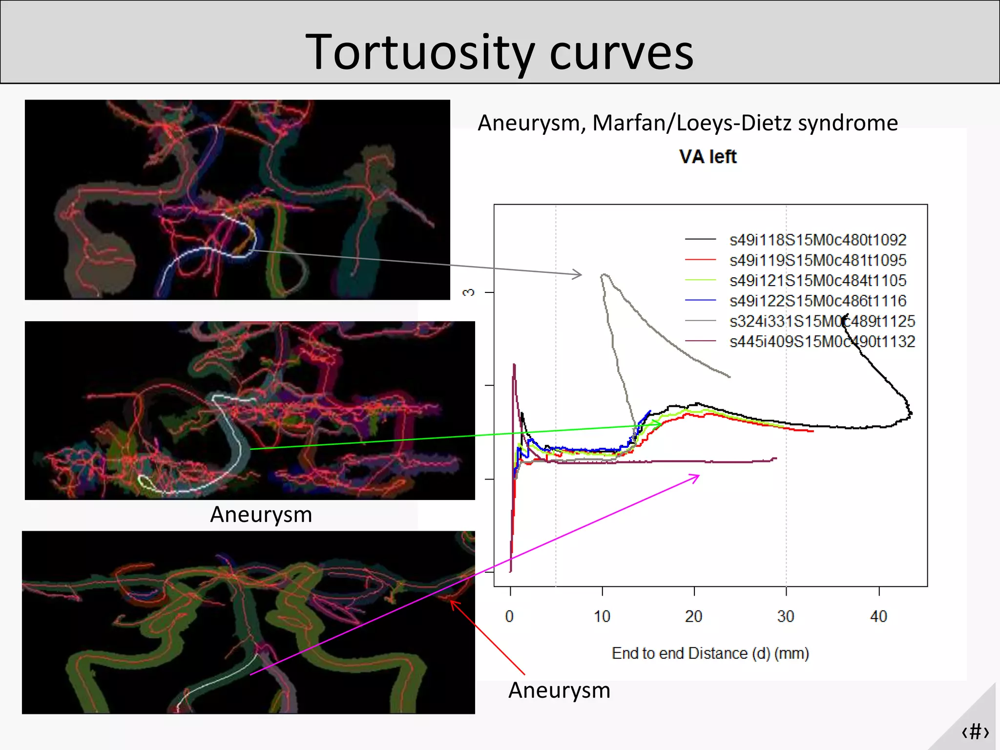 Arterial tortuosity measurement system | PPTX