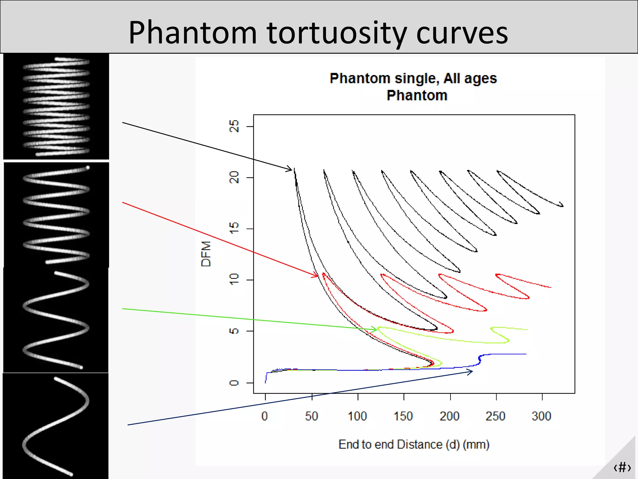 Arterial tortuosity measurement system | PPTX
