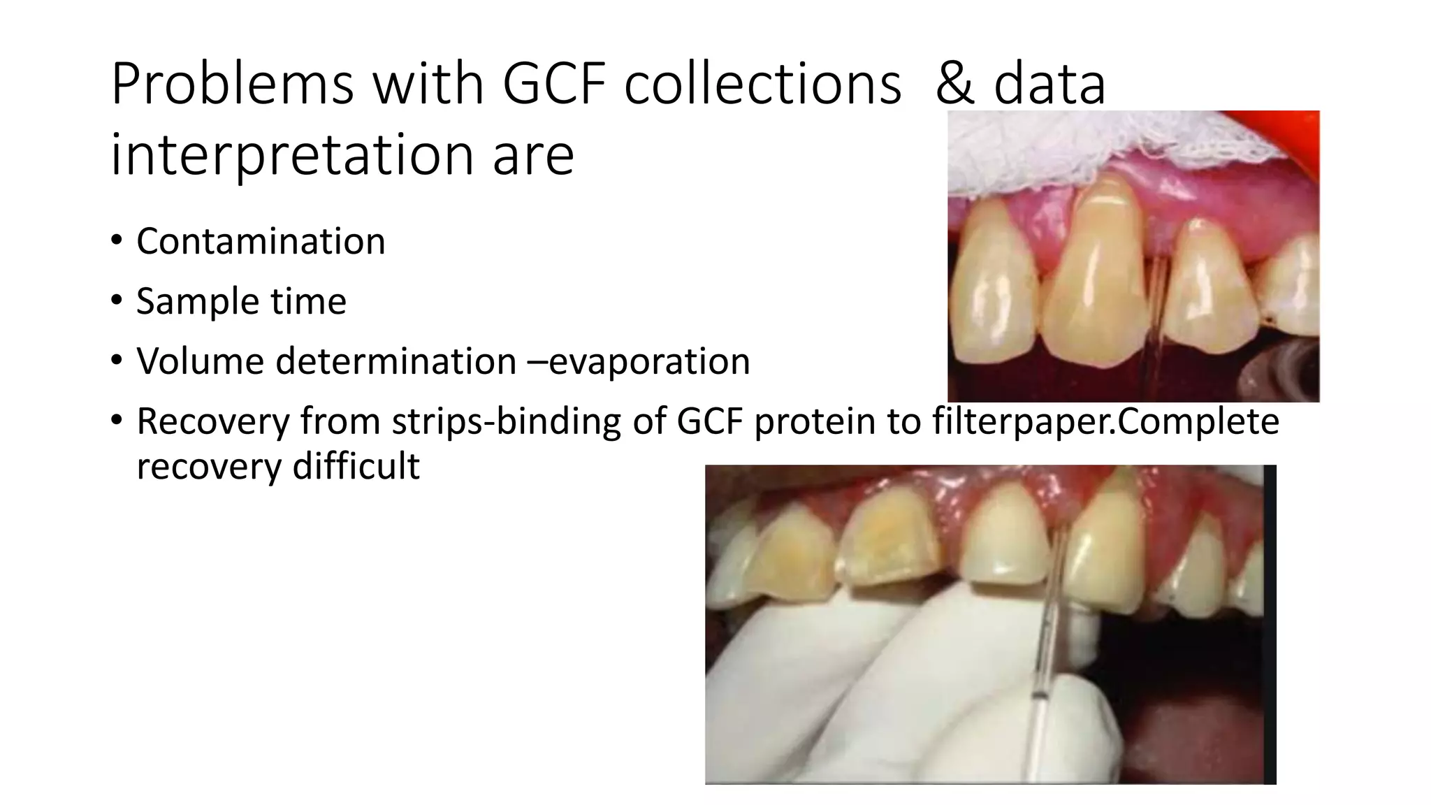 Defense mechanism of gingiva | PPTX