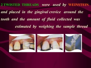 DEFENSE MECHANISMS OF GINGIVA.ppt