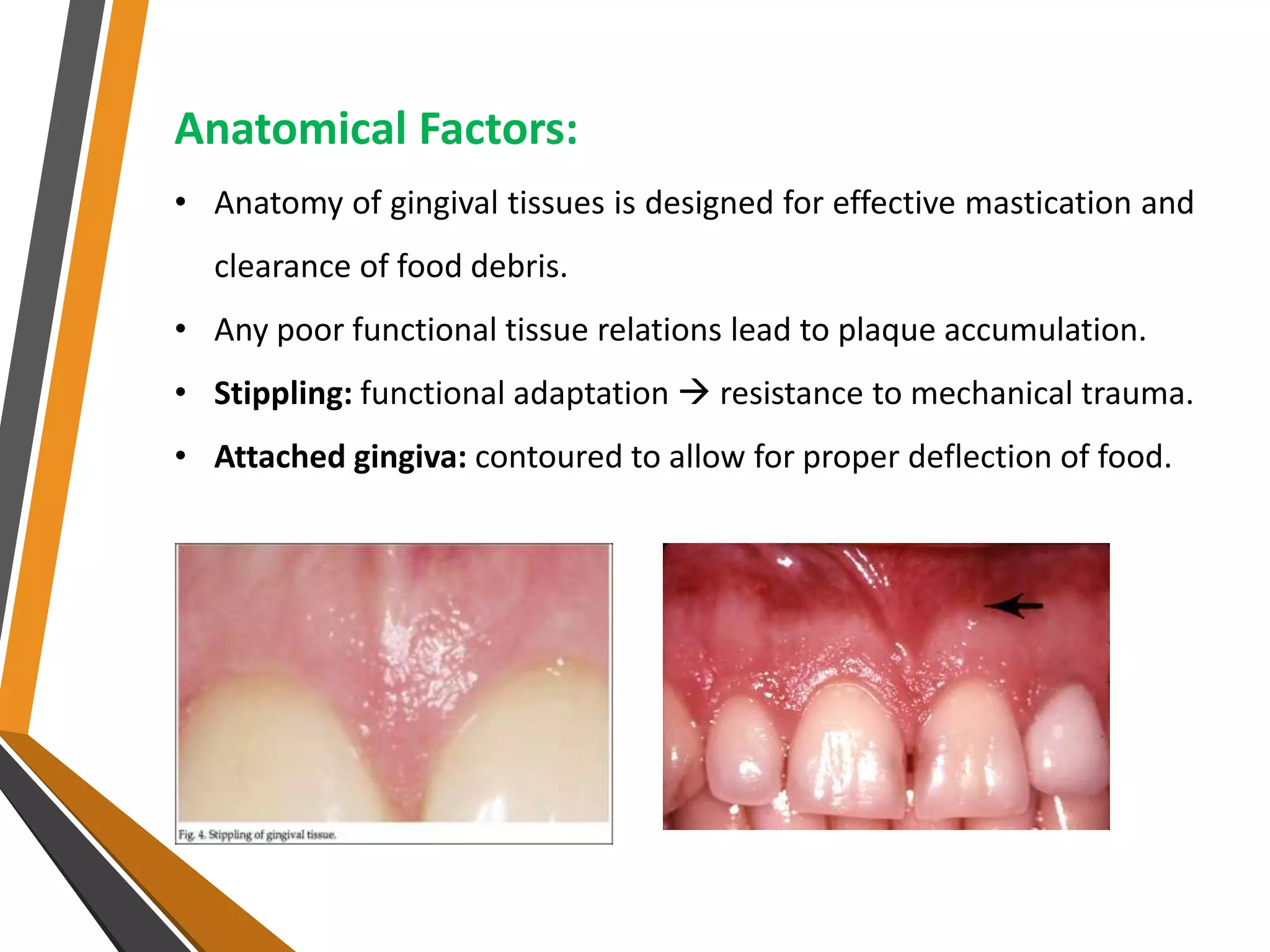 Defense mechanisms of gingiva 4 th seminar | PPTX