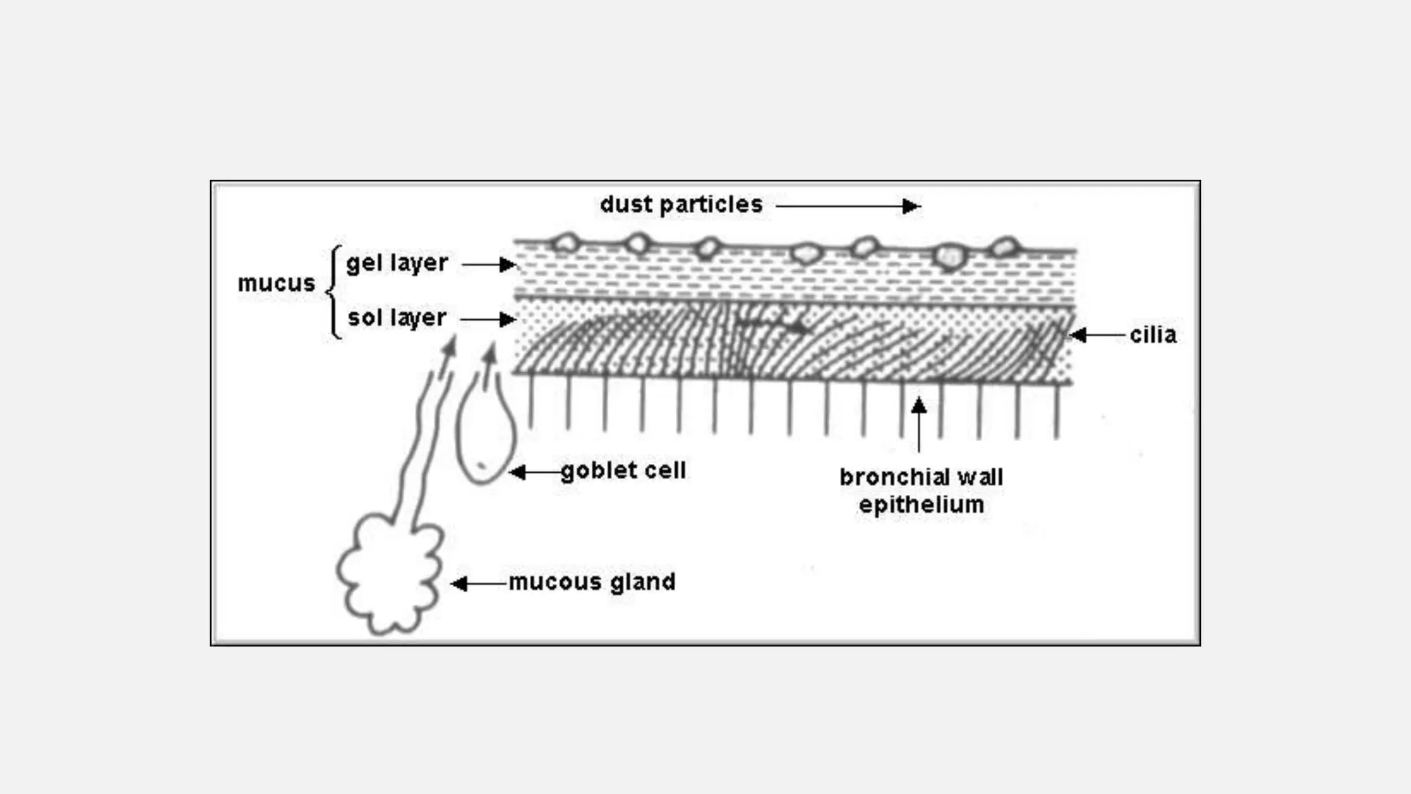 Defense Mechanisms of the Respiratory Tract - seminar 3.pptx