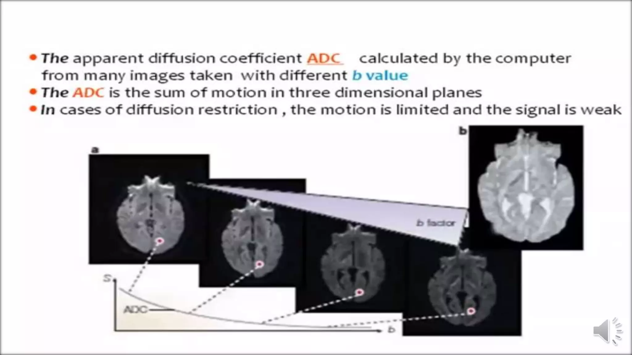 MRI Diffusion | PPTX