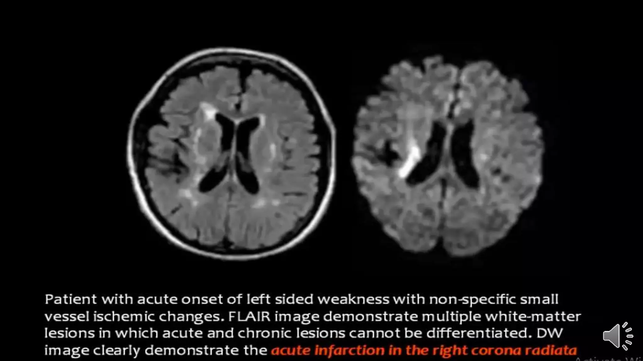 MRI Diffusion | PPTX