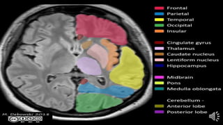 MRI Diffusion | PPTX