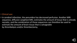 MRI Diffusion | PPTX