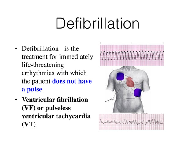 Defibrillation and cardioversion | PDF