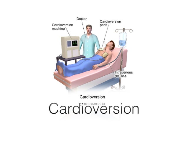 Defibrillation and cardioversion | PPT