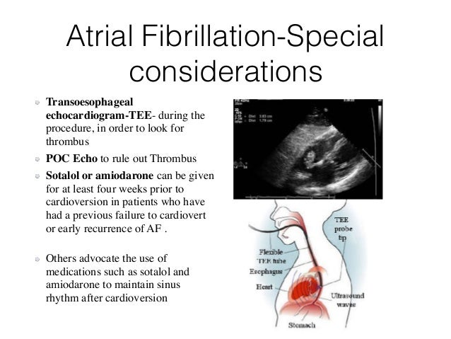 Defibrillation and cardioversion