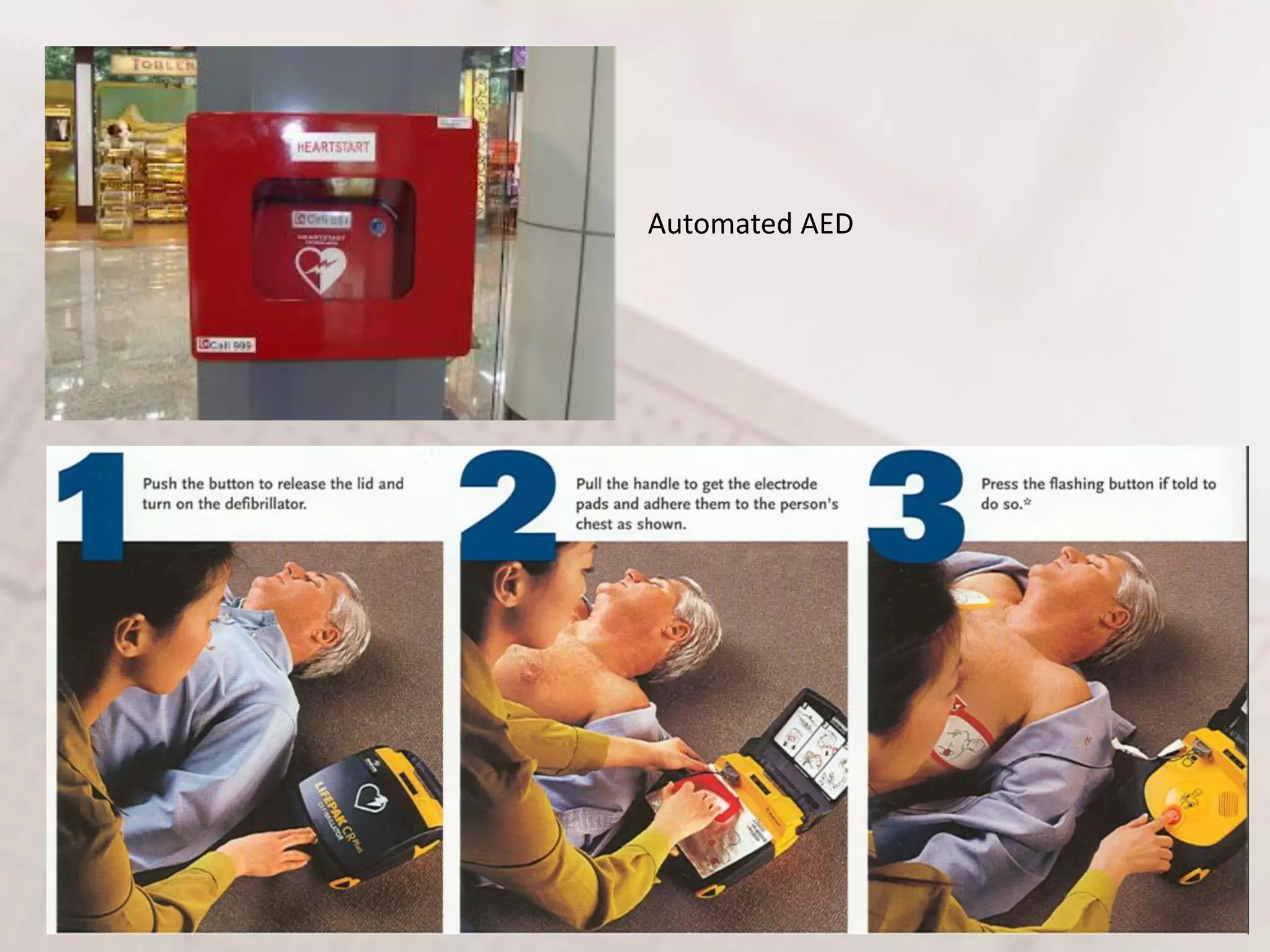 Defibrillator & cardioversion | PDF | First Aid | Injuries