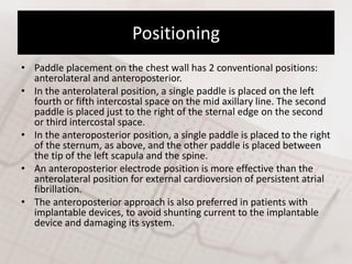 Defibrillator & cardioversion | PDF