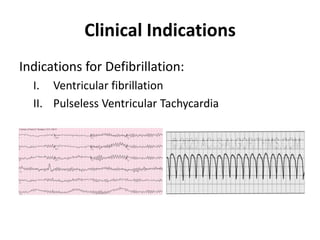 Defibrilator.pptx