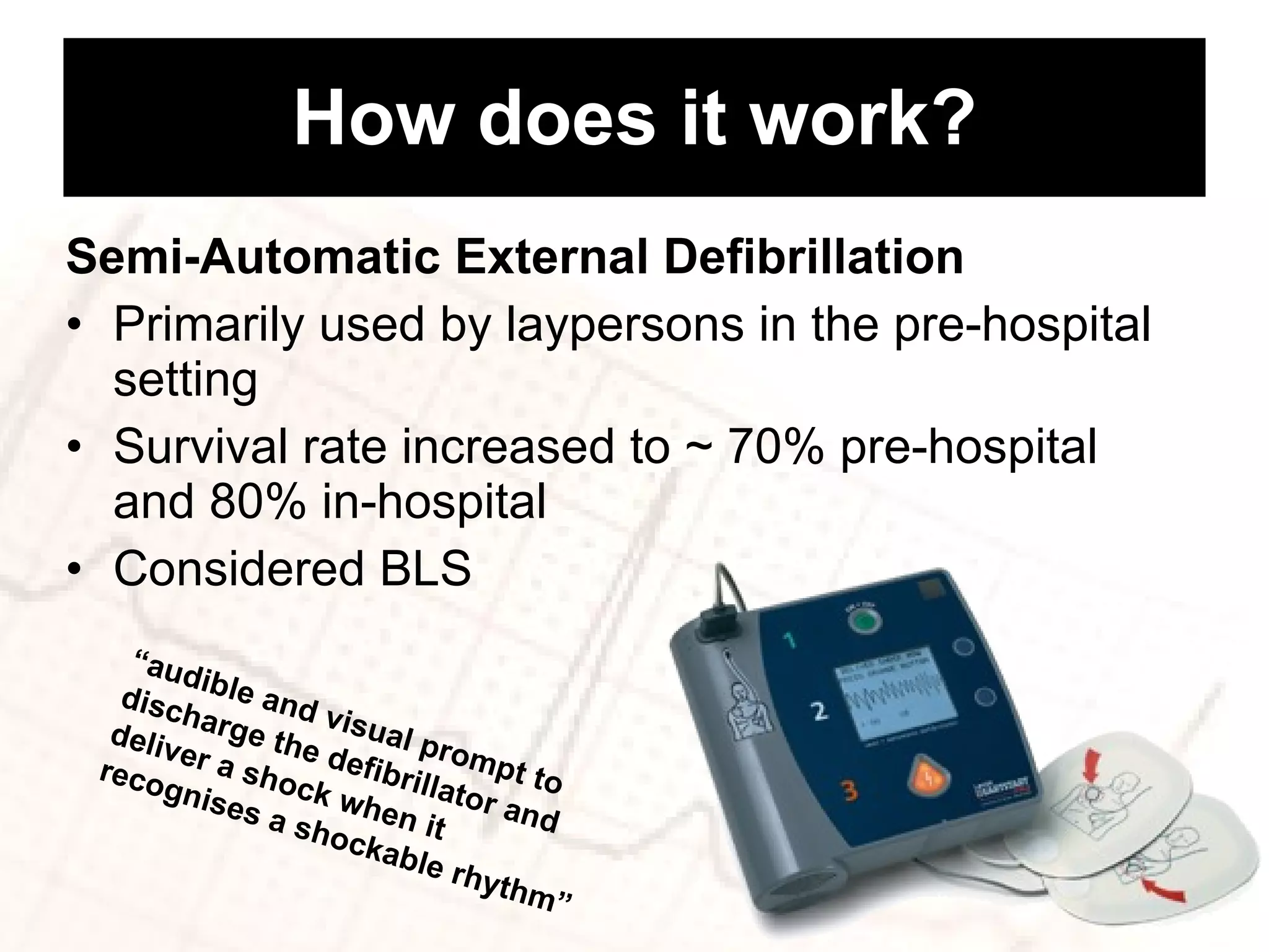 Defibrillation | PPT