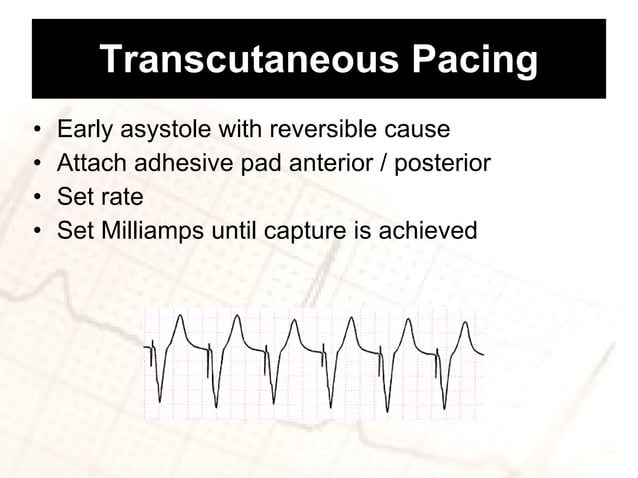 Defibrillation | PPT | First Aid | Injuries
