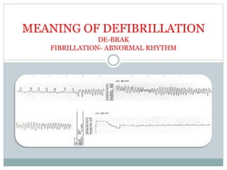 Defibrillation | PPTX | Heart and Cardiovascular Diseases | Diseases ...