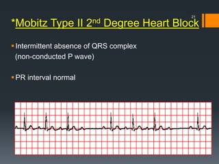 Defibrillation, cardioversion and pacing | PPTX