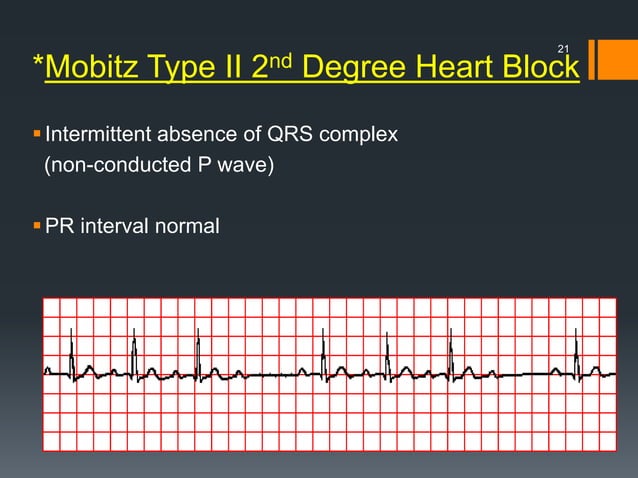 Defibrillation, cardioversion and pacing | PPTX