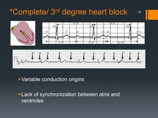 Defibrillation, cardioversion and pacing | PPTX