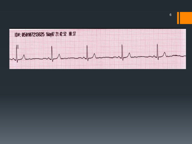 Defibrillation, cardioversion and pacing | PPTX