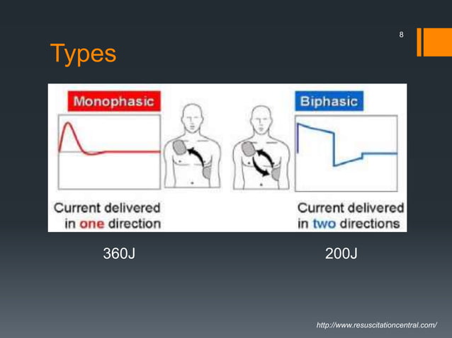 Defibrillation, cardioversion and pacing | PPTX