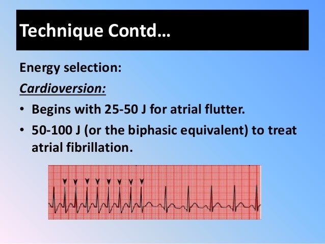 Defibrillation & cardioversion by DJ