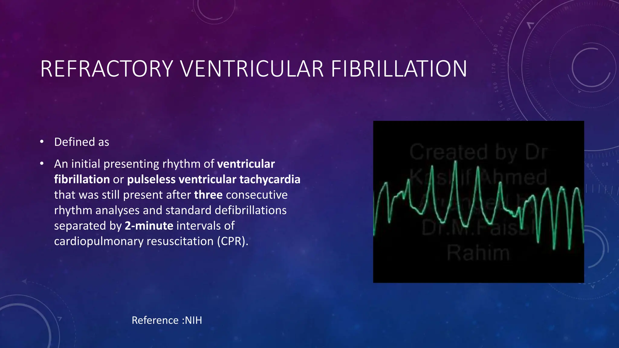 Defibrillation strategies new techniques.pptx