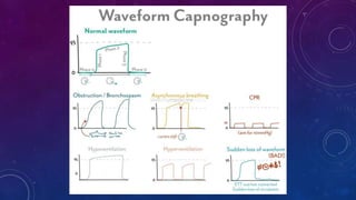 Defibrillation strategies new techniques.pptx