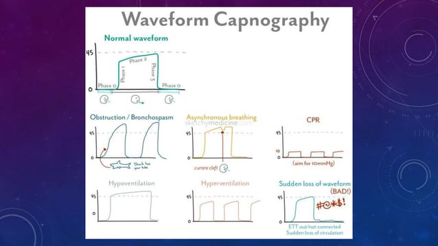Defibrillation strategies new techniques.pptx