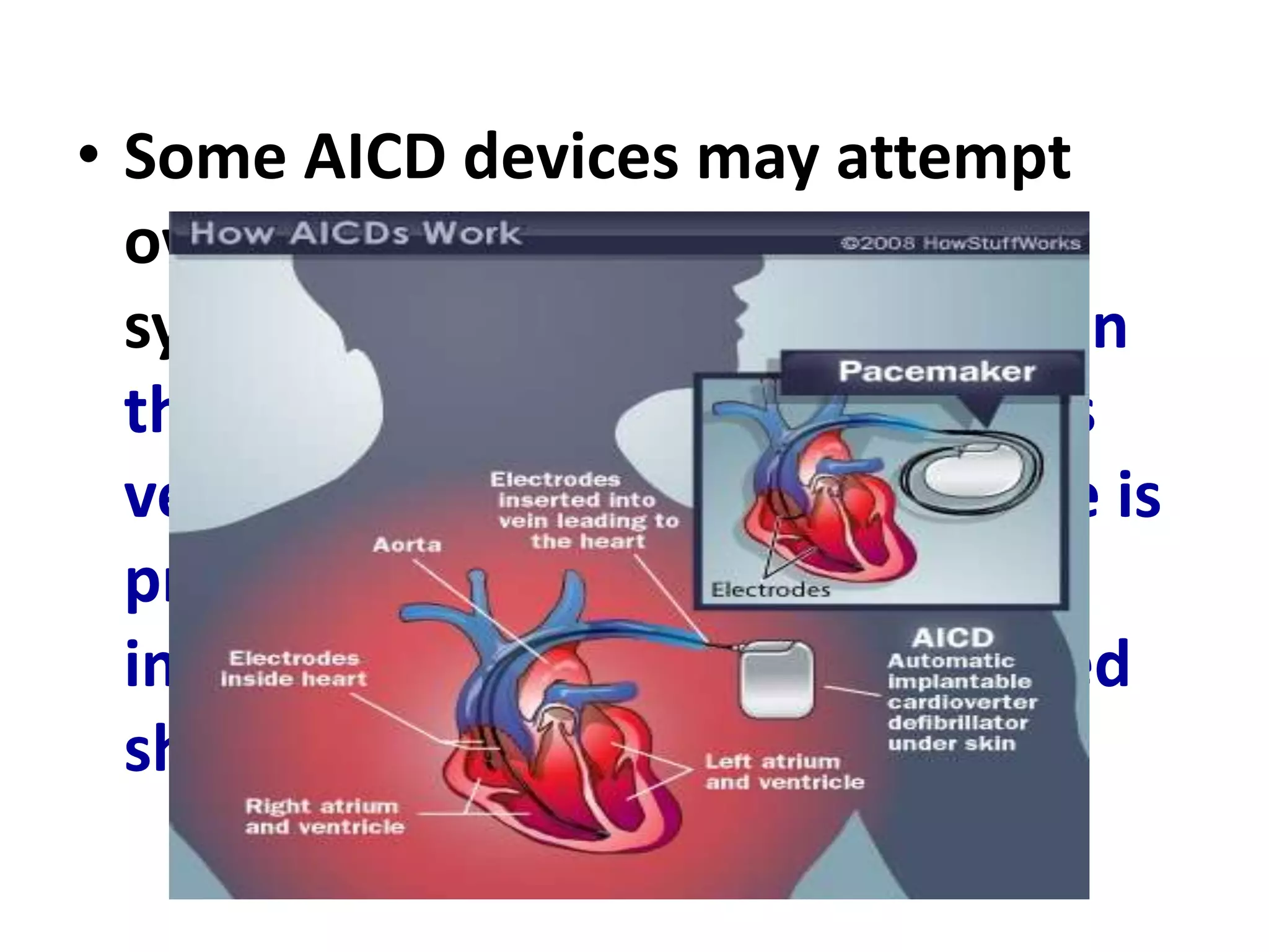 DEFIBRILLATOR | PPTX