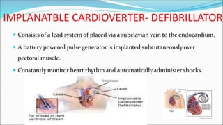Defibrillator | PPTX