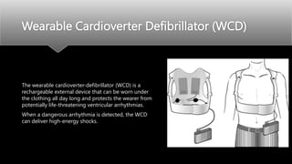 DEFIBRILLATOR.pptx