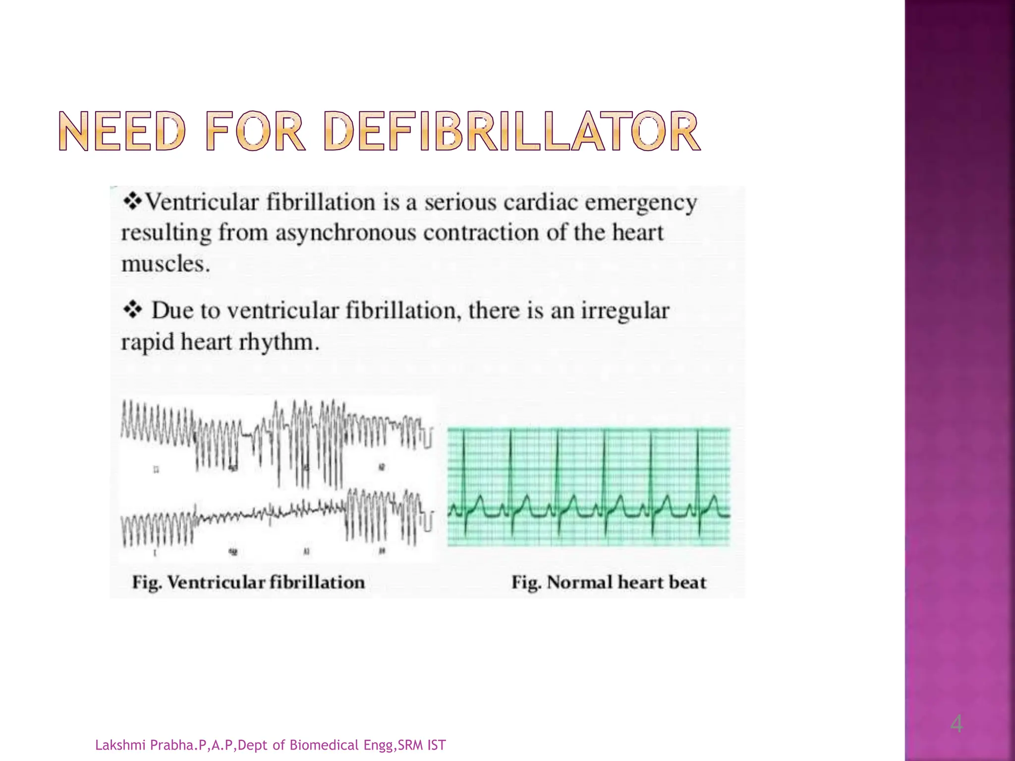 Defibrillator Biomedical instrumentation.pptx