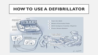 Defibrillator.pptx biomedical instrument | PPT