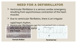 DEFIBRILLATOR.akash pptttttttttttttttttt | PPT