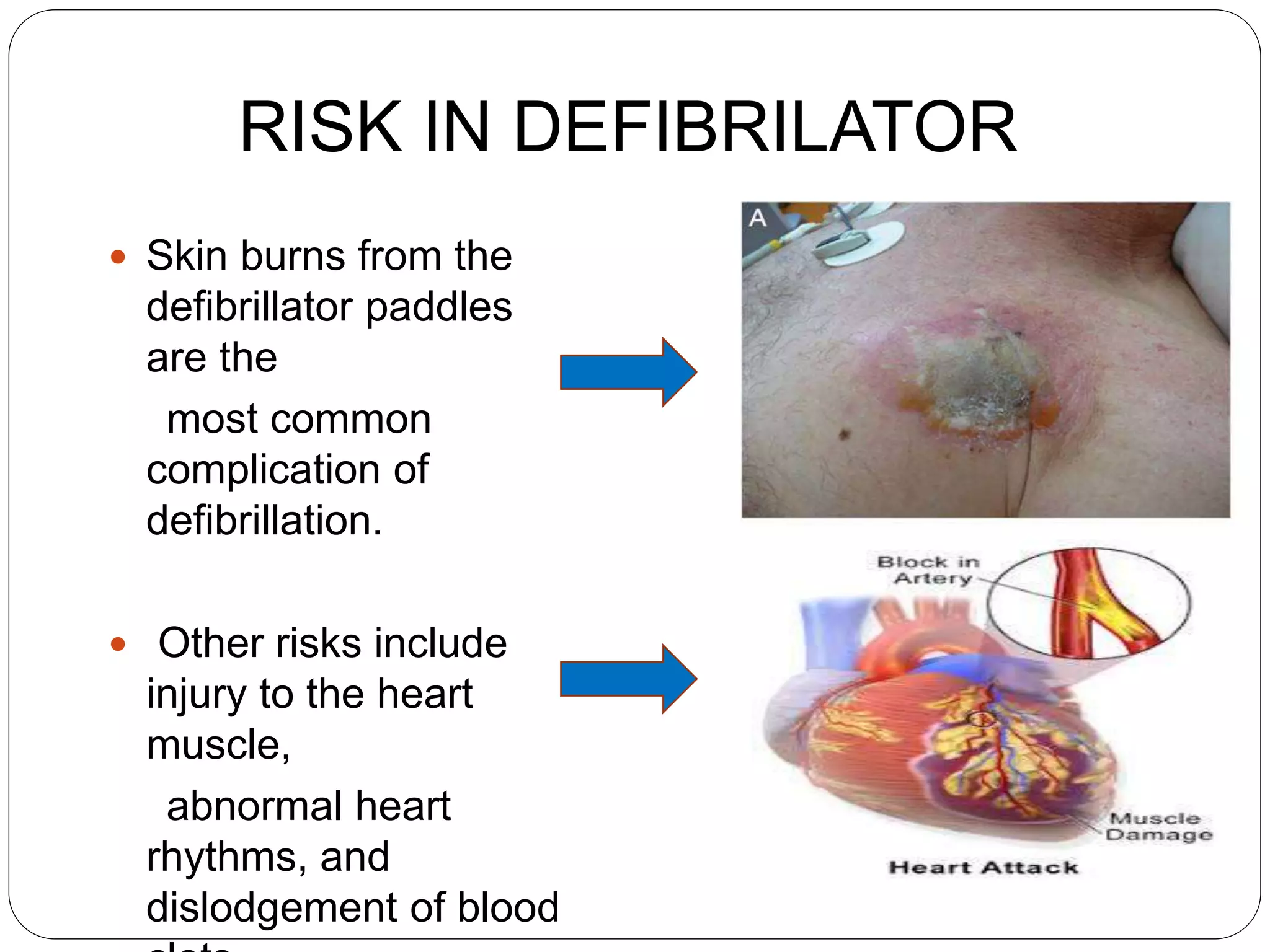 Defibrillator prakash | PPTX | First Aid | Injuries