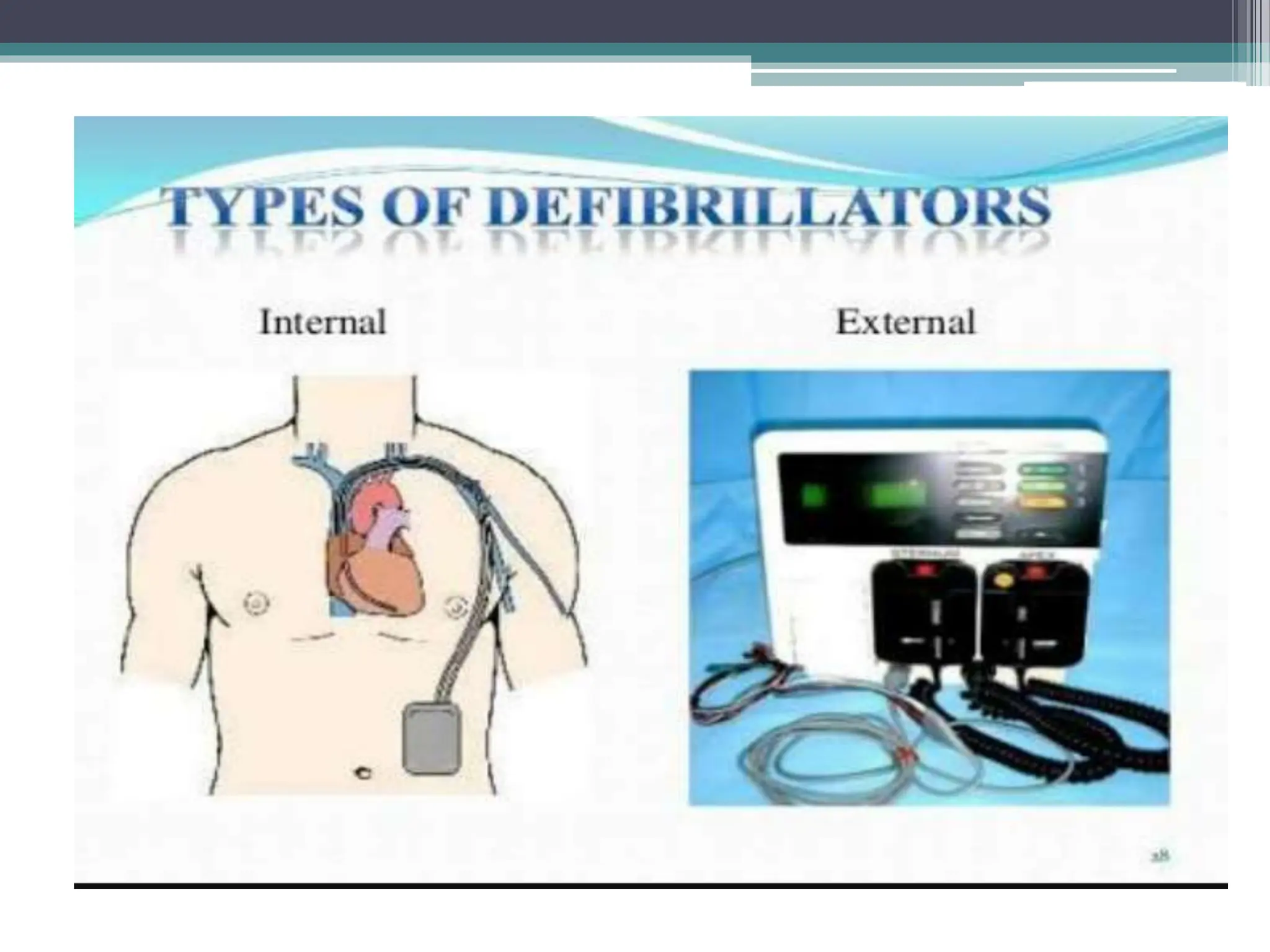 DEFIBRILLATOR AND CARDIOVERSION - NURSES RESPONSIBILITY | PPTX