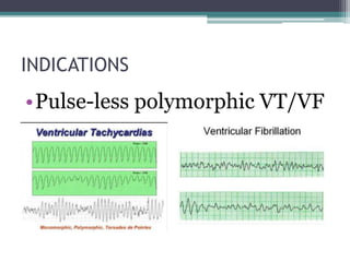 DEFIBRILLATOR AND CARDIOVERSION - NURSES RESPONSIBILITY | PPTX