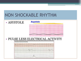 DEFIBRILLATOR AND CARDIOVERSION - NURSES RESPONSIBILITY | PPTX